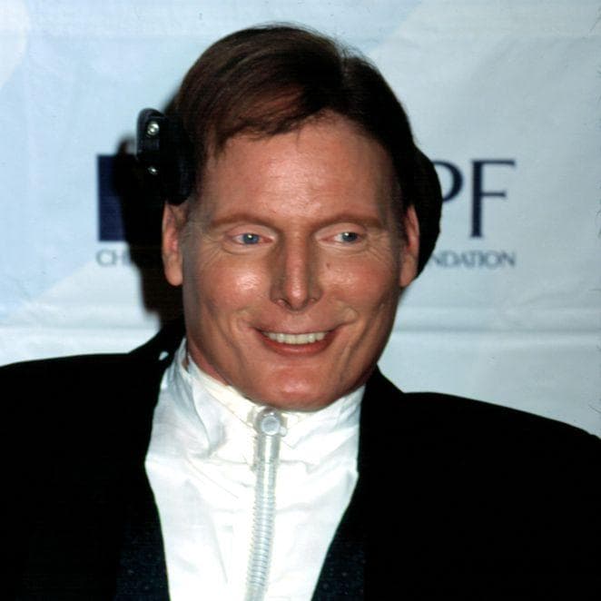 Famous People Who Died of Sepsis | List of Celebrity Sepsis Deaths