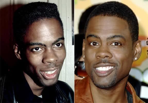 Celebrities with Fake Teeth | List of Famous People with Dentures and ...