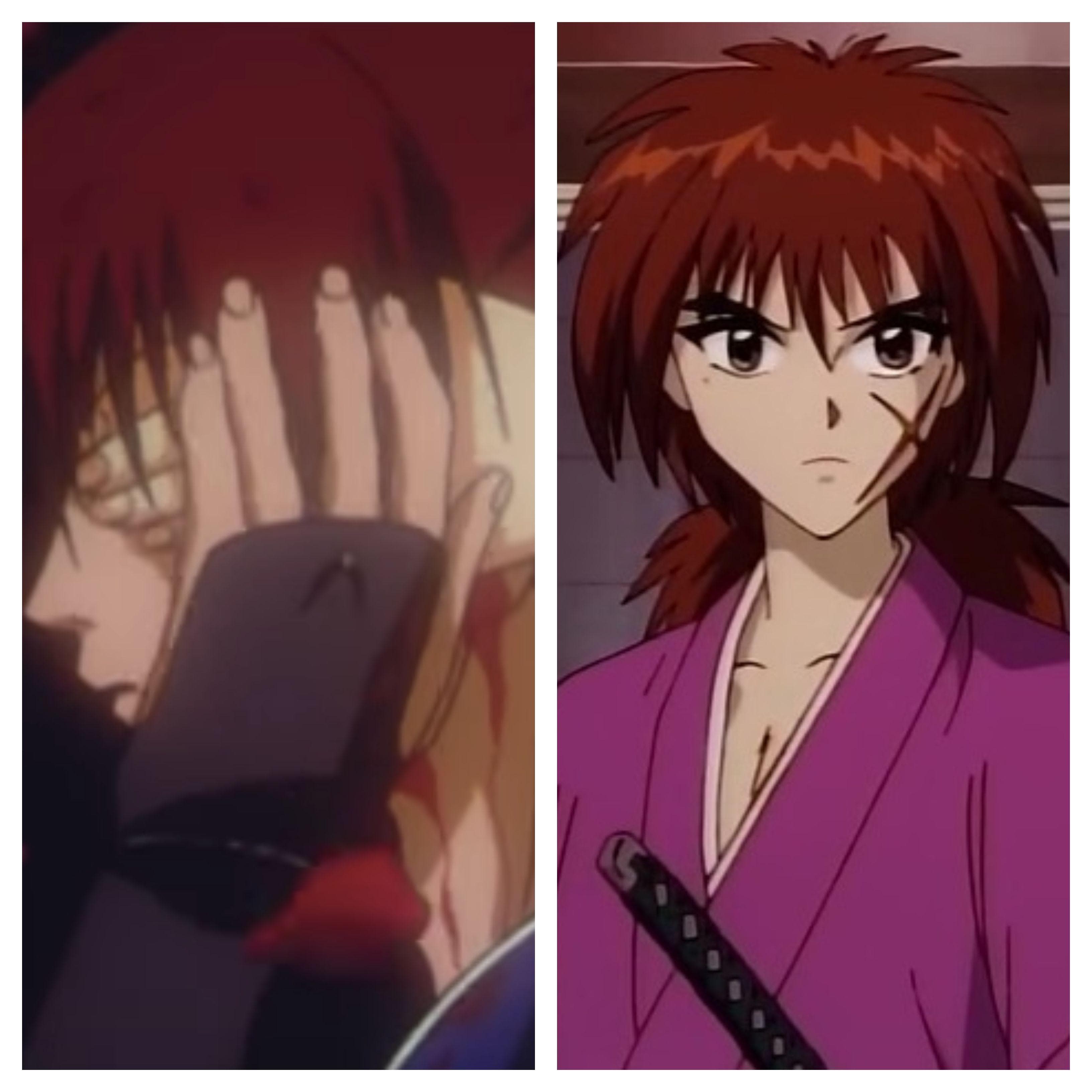 15 Times Anime Characters Were Permanently Wounded By Battle