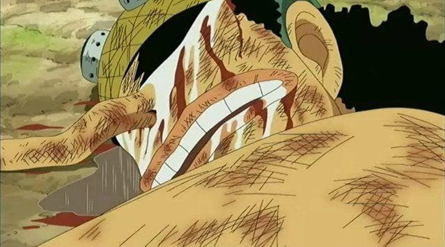 The 15 Worst Injuries Usopp Has Suffered in One Piece