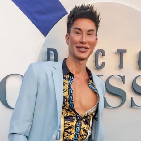 Celebrities Who Are Open About Their Plastic Surgery, Ranked