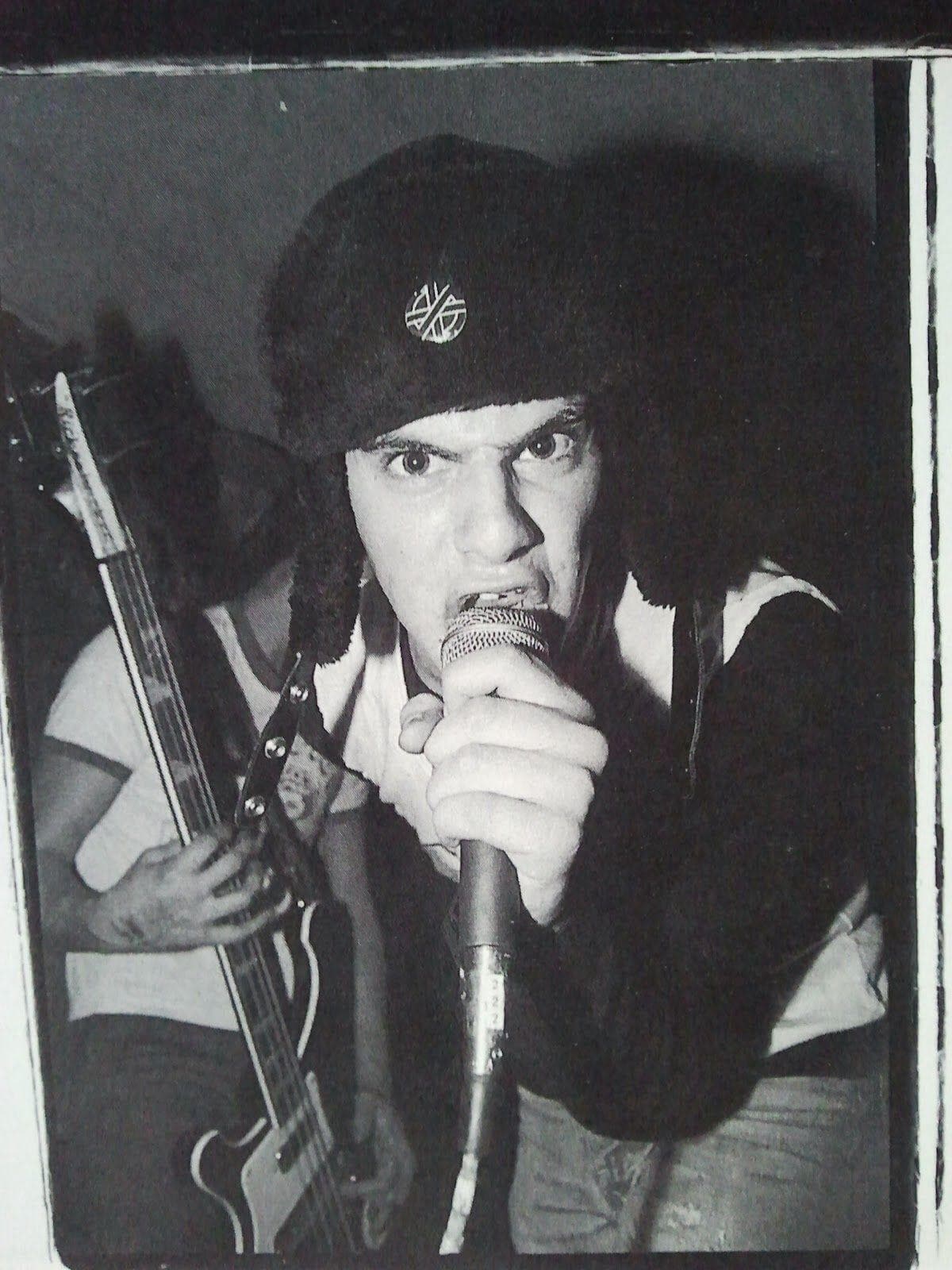 12 Twisted Before & After Stories of Lobotomy Victims