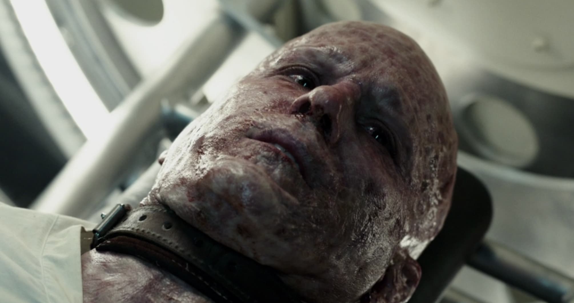 How 15 Famous Characters Got Their Scars, Ranked