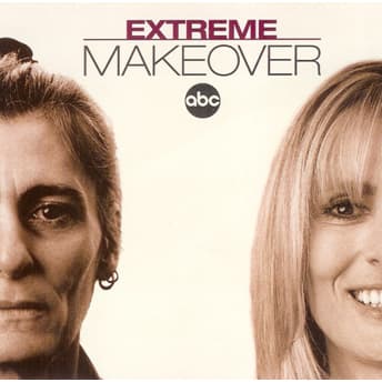 The 14 Best TV Shows About Plastic Surgery