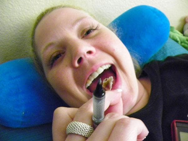 Bizarre Eating Disorder Stories | List of Strange Eating Disorders