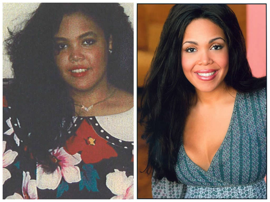 35+ Celebrities Who Had Weight Loss Surgery