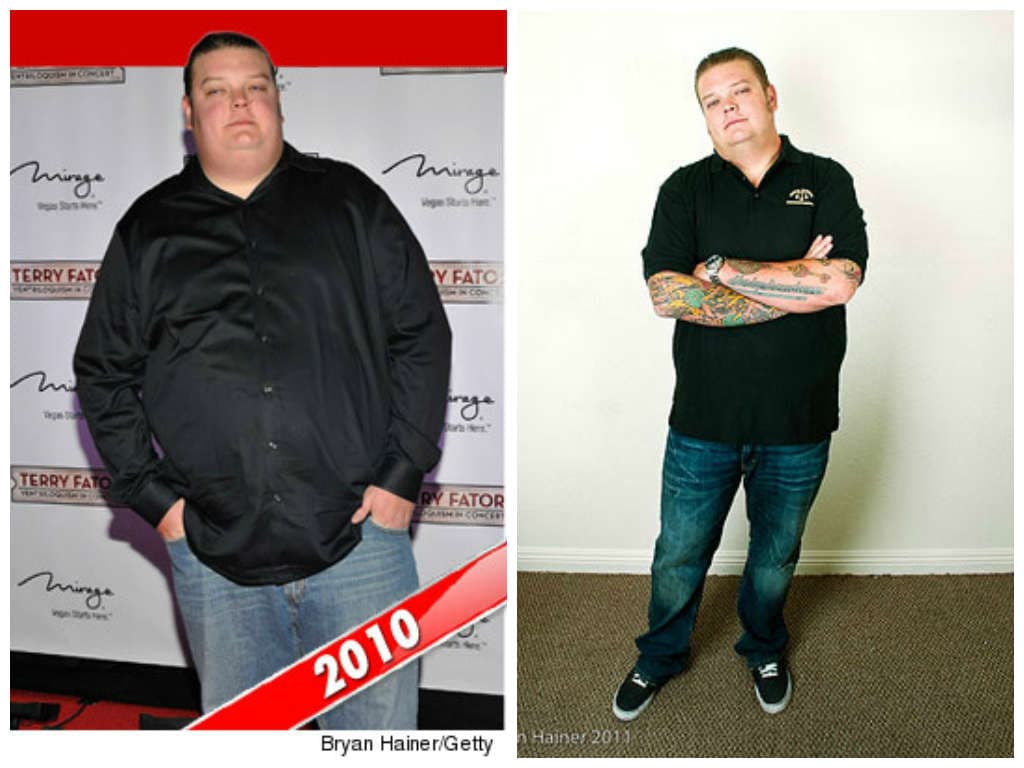 35+ Celebrities Who Had Weight Loss Surgery