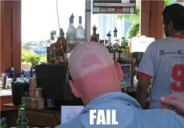 Funny Sunburn Jokes