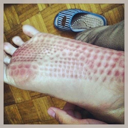 These Vomit-Inducing Photos Will Trigger Your Trypophobia