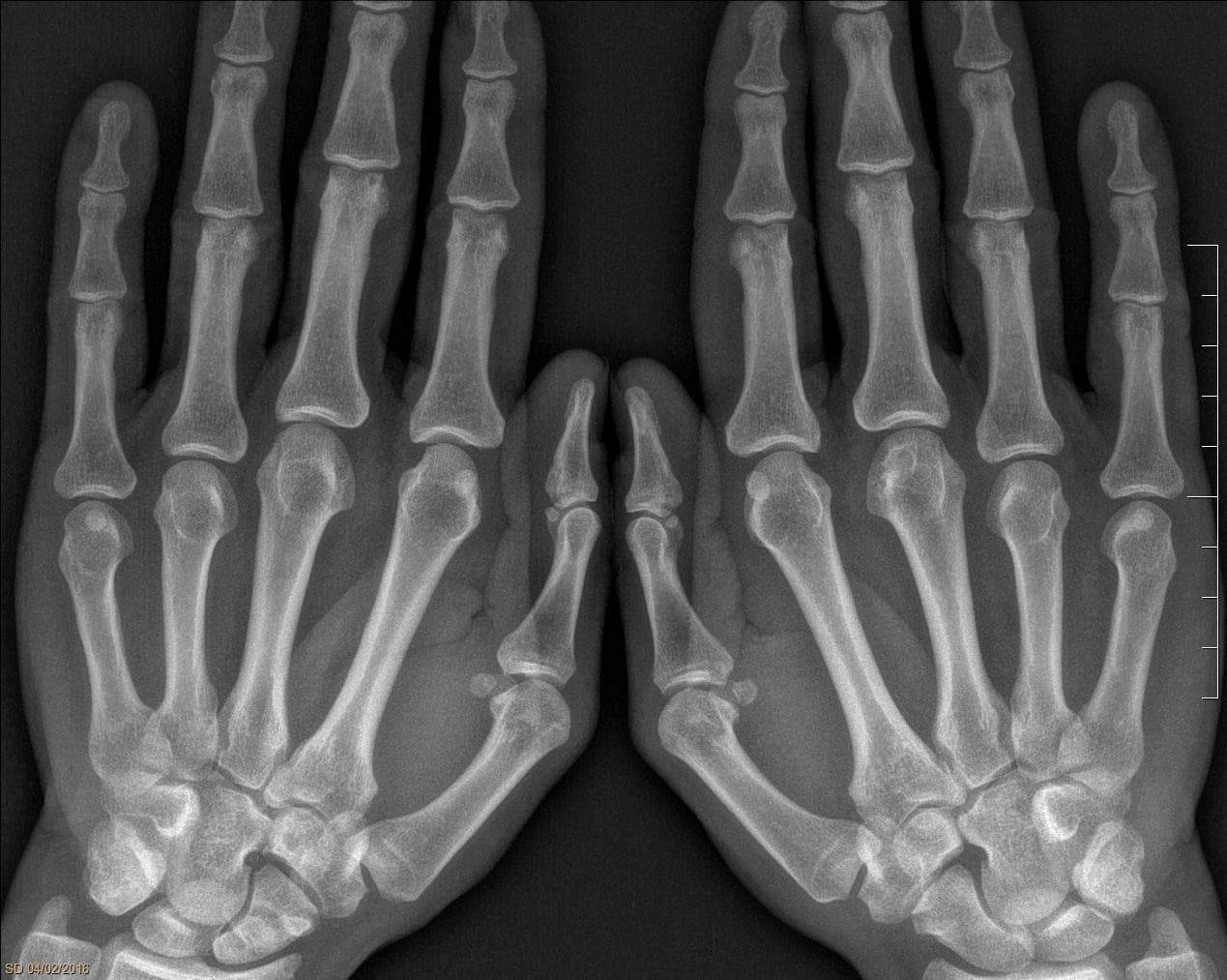 Serial Killer Souvenirs | Trophies of Serial Killers