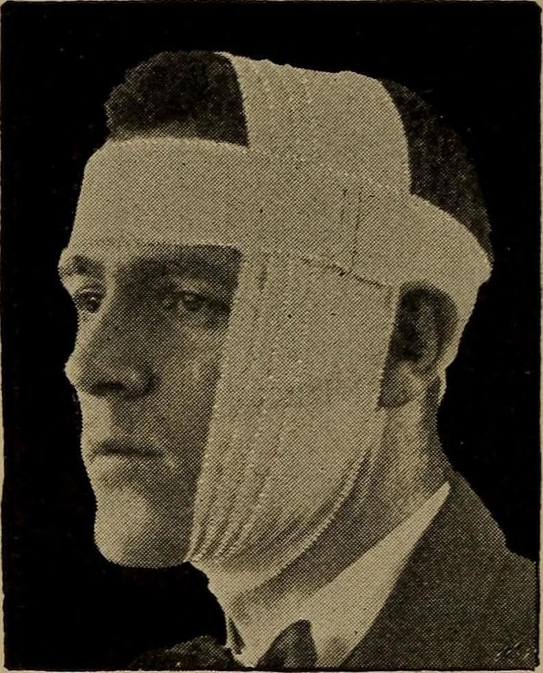 Anesthesia Awareness | People Who Woke Up During Surgery