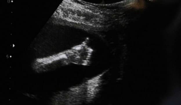 29 Funny Ultrasound Pictures That'll Creep You Out