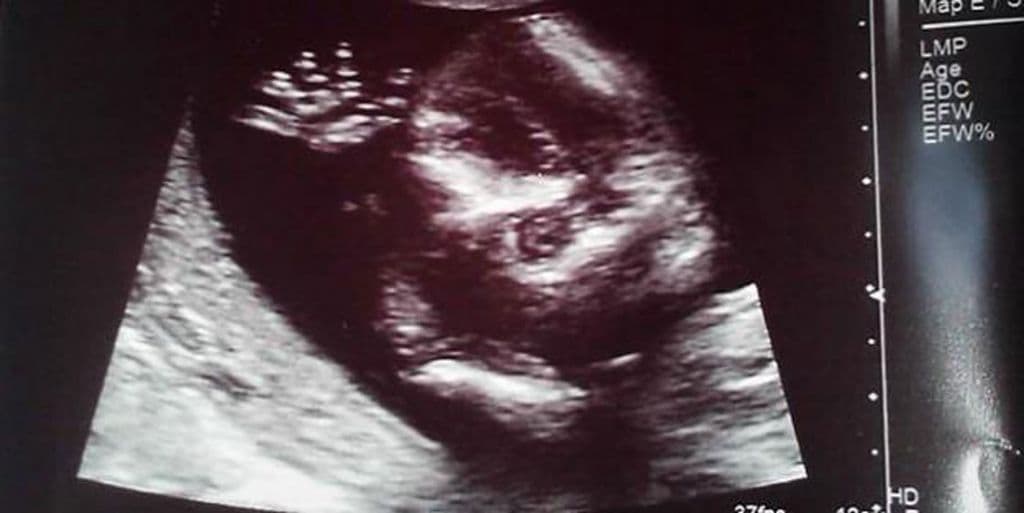 29 Funny Ultrasound Pictures That'll Creep You Out