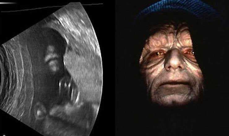 29 Funny Ultrasound Pictures That'll Creep You Out