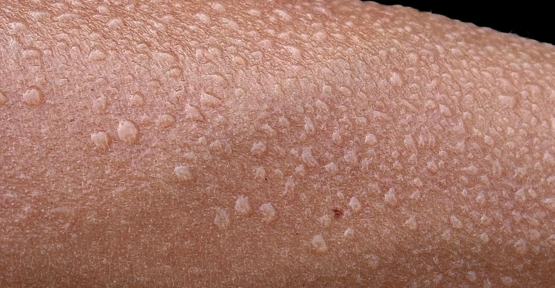 How to Poop in Space: A Guide to Astronaut Toilets and More