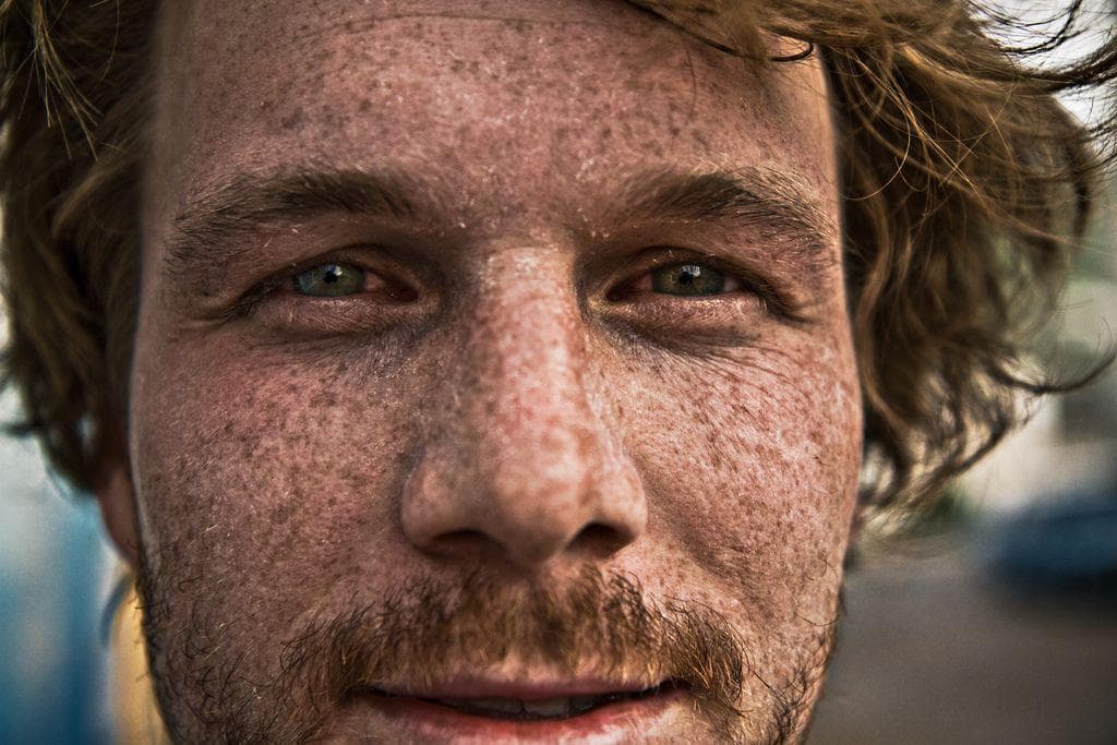 The Most Common Recessive Genes in Humans