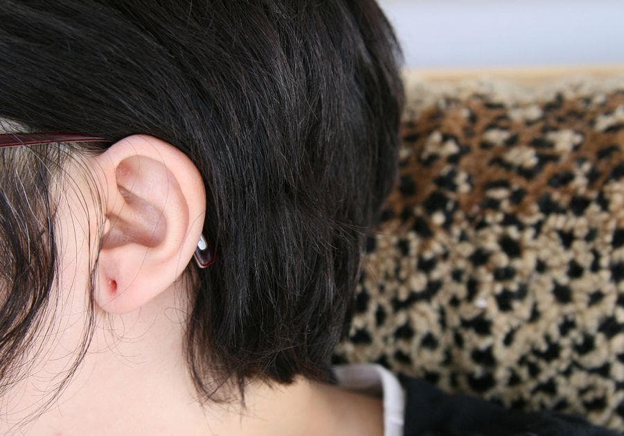 The Most Dominant Genes in Humans