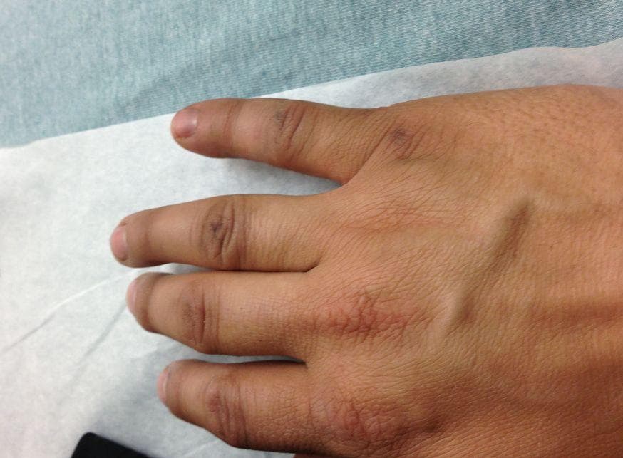 The Most Dominant Genes in Humans