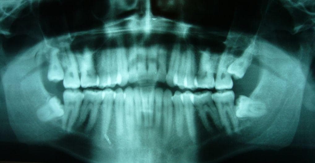 Surprising Traits You Didn't Know Were Vestigial