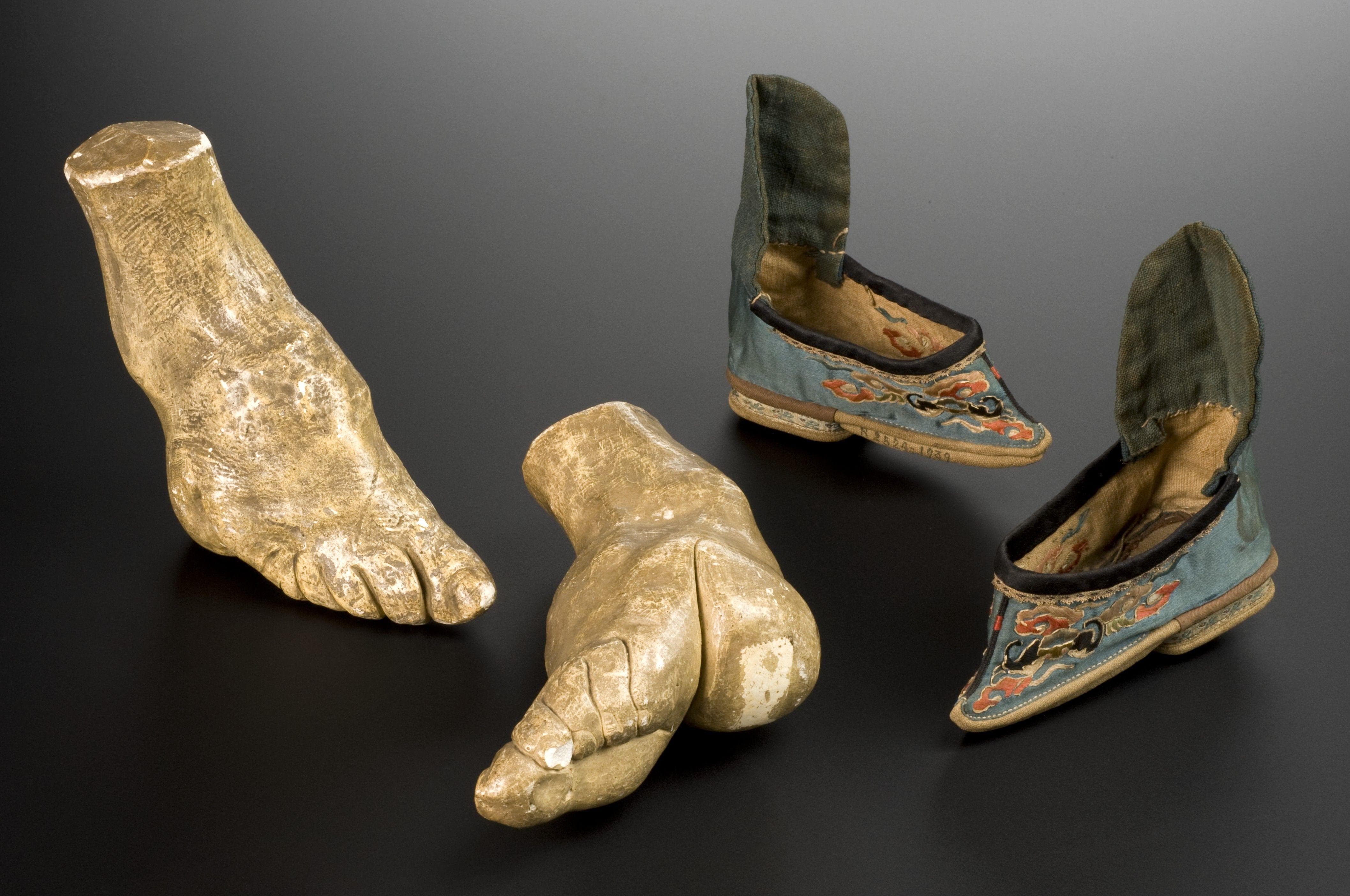 Crazy Things You Didn't Know about Ancient Chinese Foot Binding