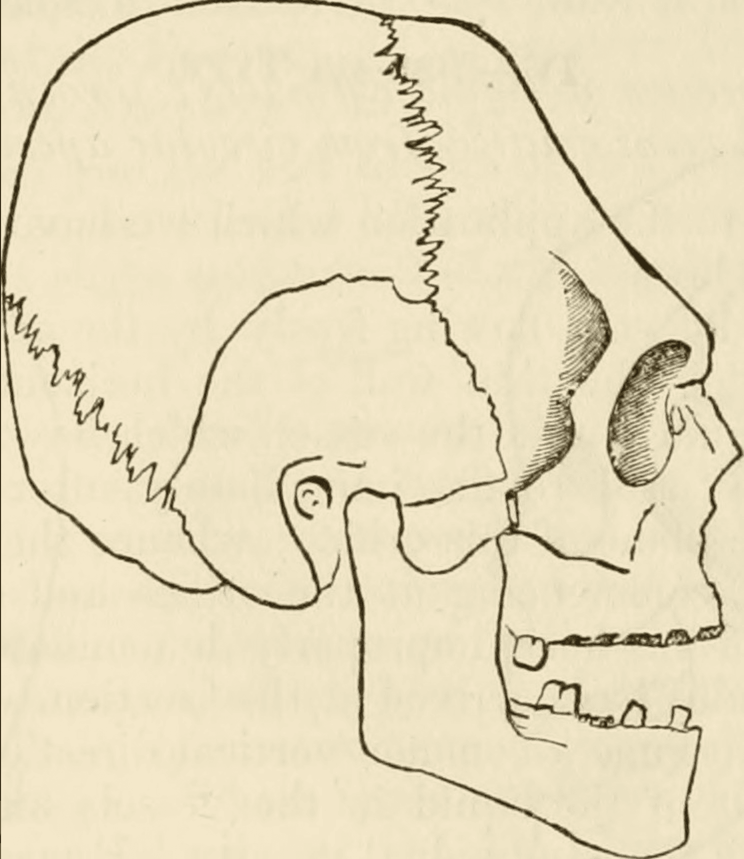 Everything You Should Know About Ancient Coneheads