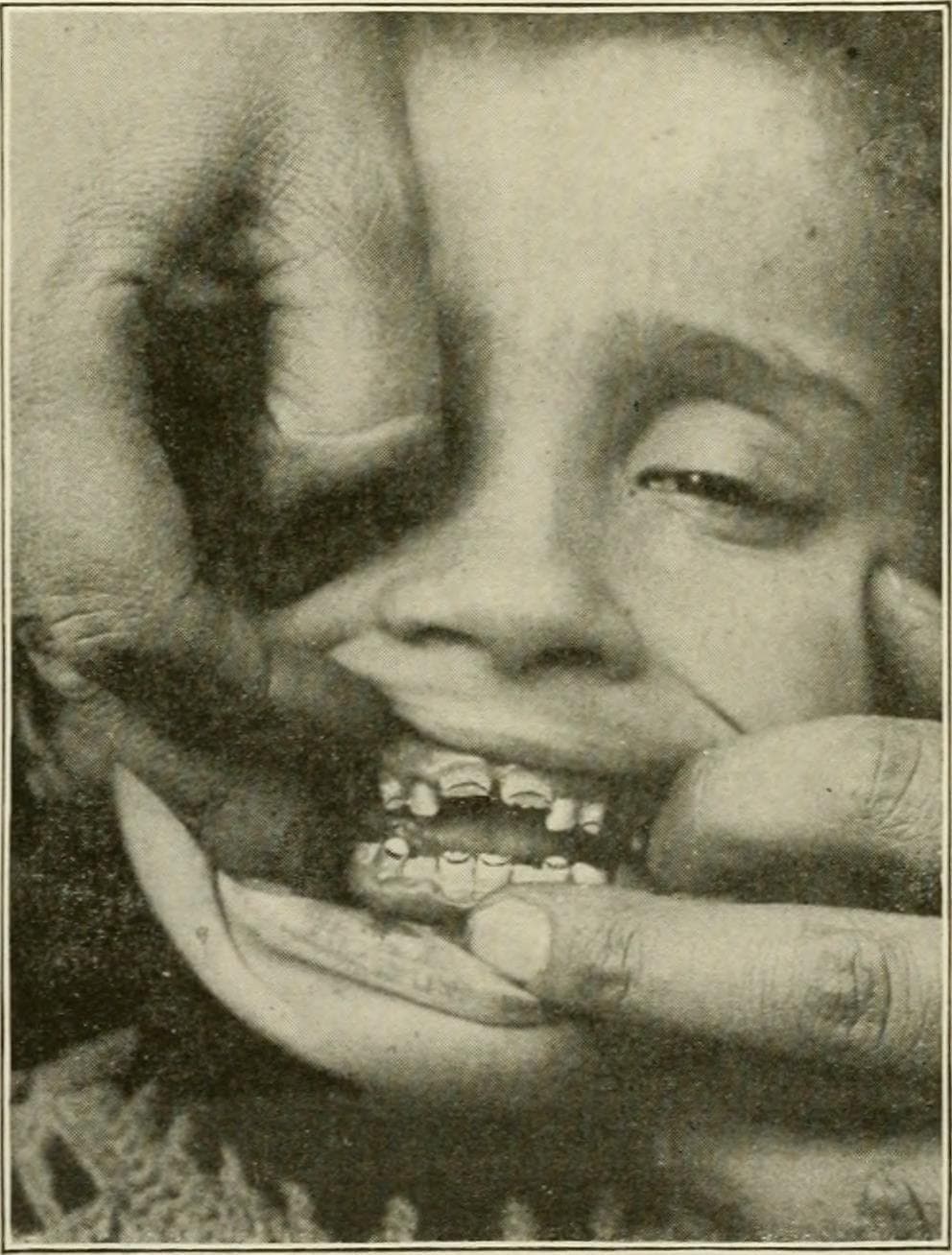 Things Ancient People Did in the Name of Health That Were Terrible for Them