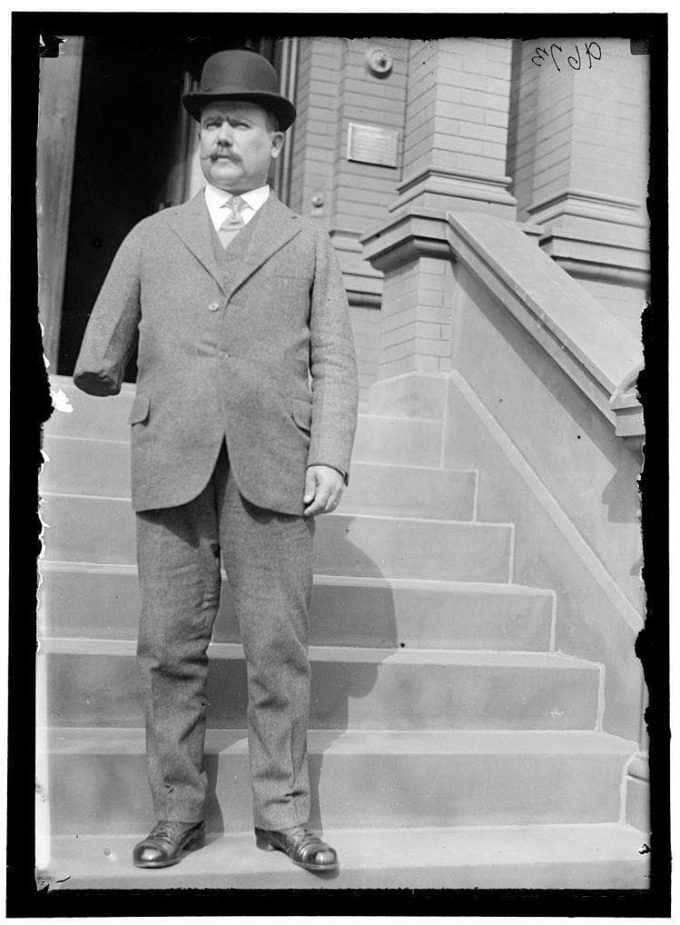 Phantom Limbs: What Happens to Your Body After Amputation