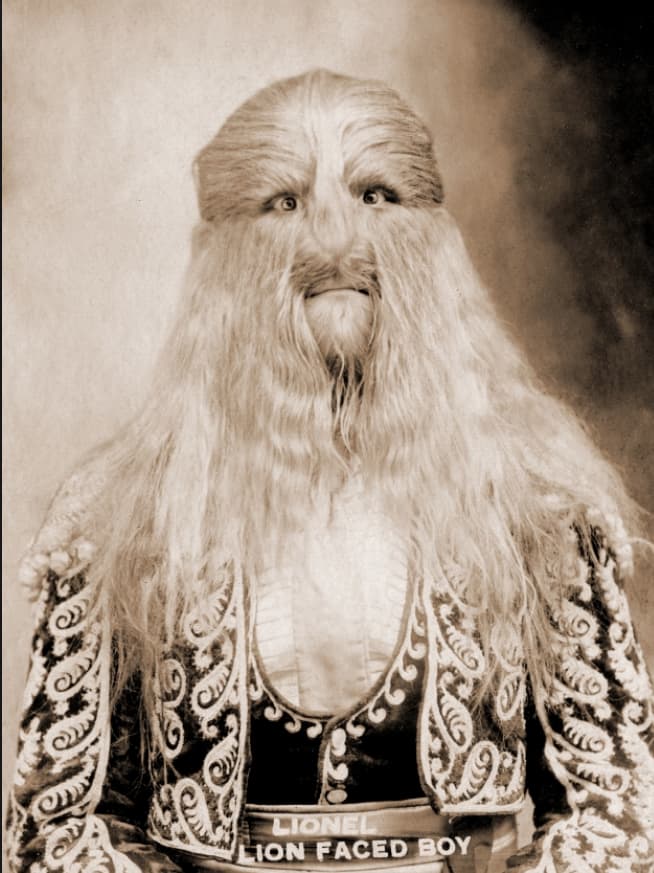 Famous Circus Sideshow Performers in History