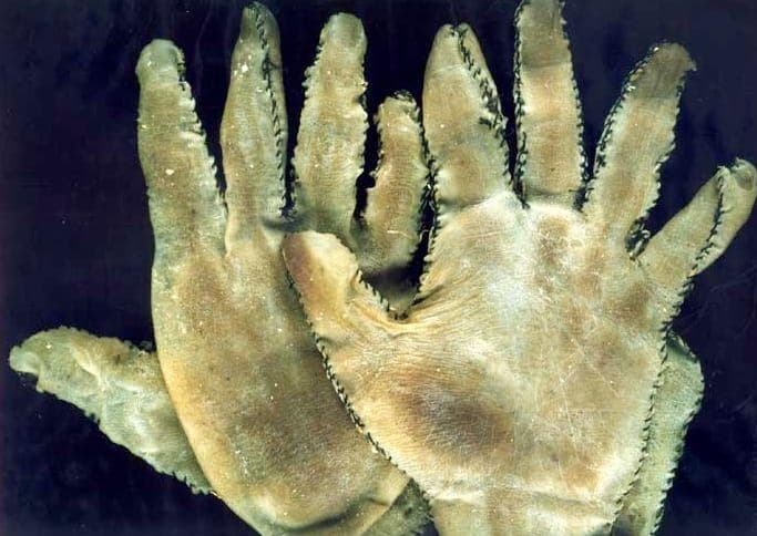 10 Random Objects That Were Actually Made Out of Human Skin