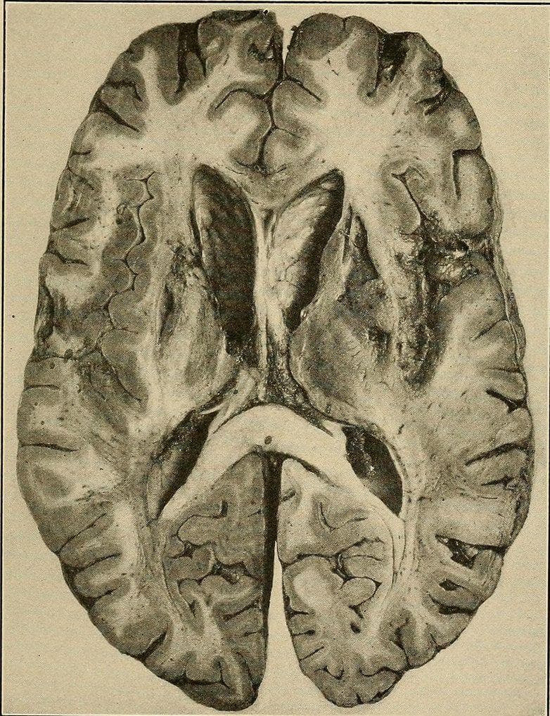 Antiquated Medical Terminology