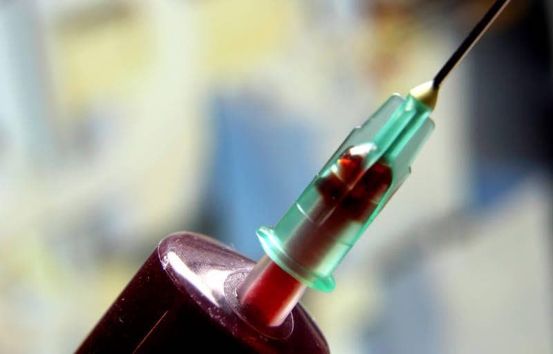 What Happens to Your Body When its Embalmed