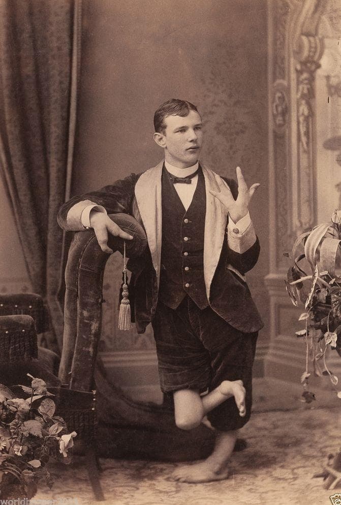 Victorian Circus Freaks
