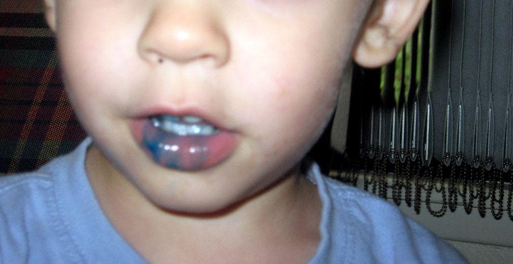 What It's Like to Choke to Death (Page 3)