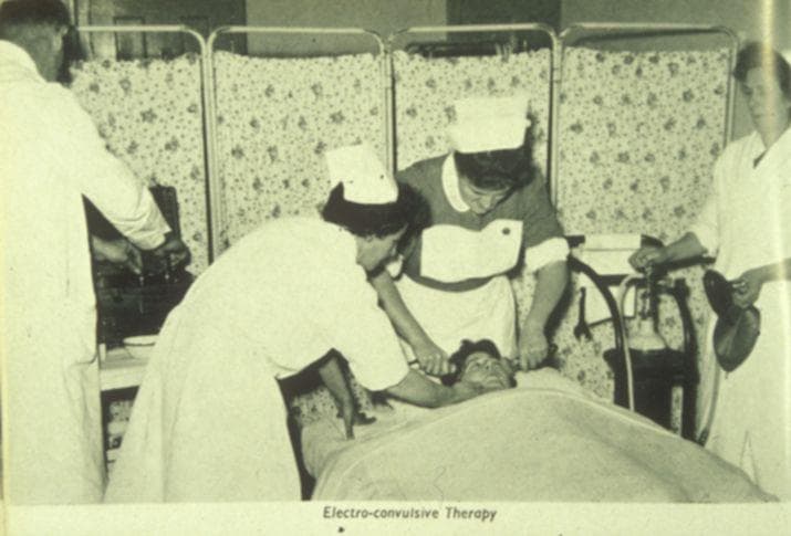 11 Morbid Historical Facts About Electroconvulsive Therapy