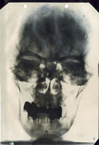 8 Pieces of Evidence That Hitler Possibly Survived World War II