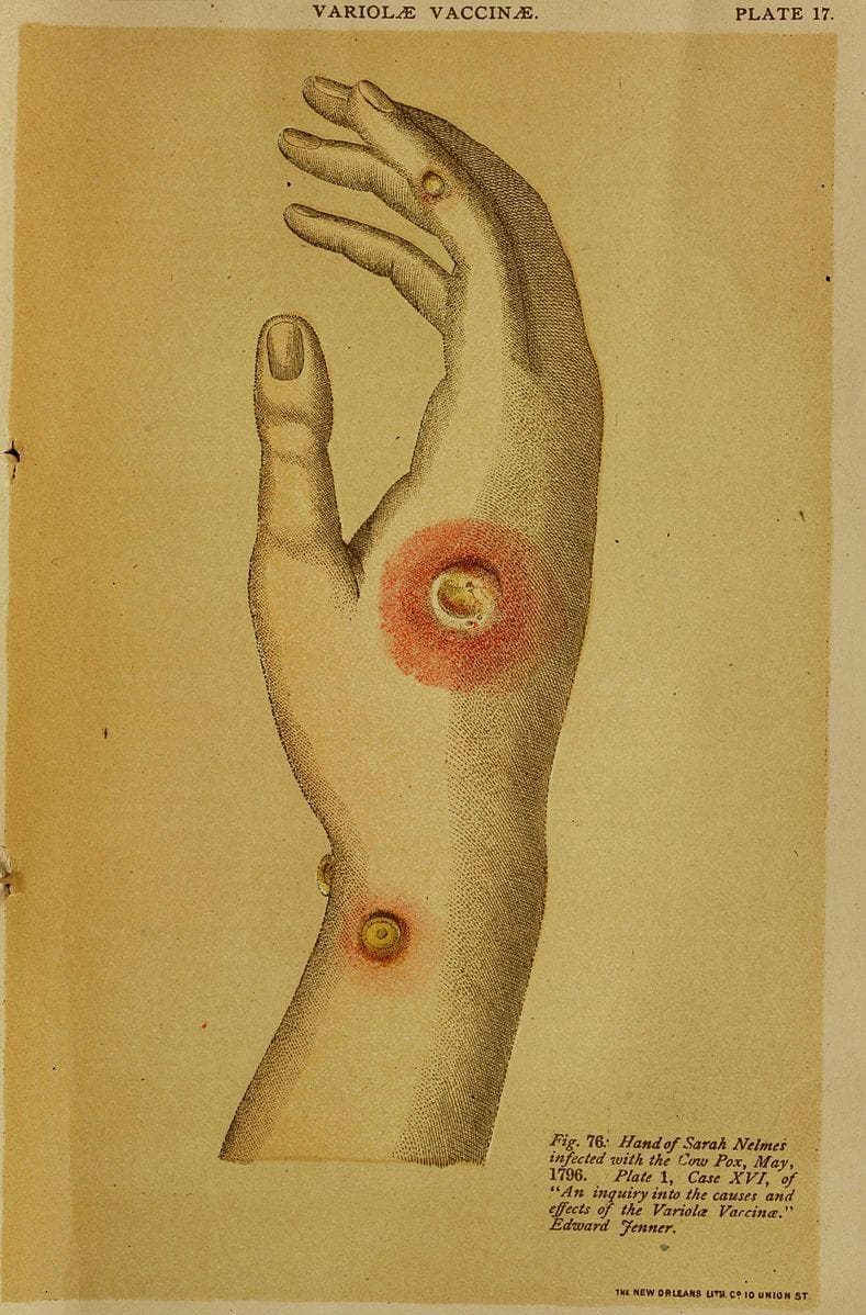 15 Devastating Epidemics That Have Threatened Humanity