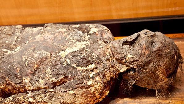 14 Super Weird And Disgusting Things On Display At The Mütter Museum