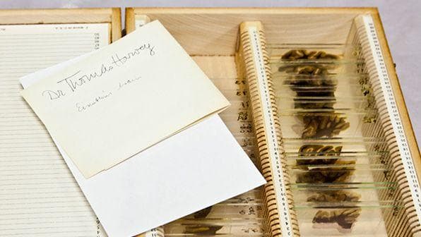 13 Super Weird And Disgusting Things On Display At The Mütter Museum