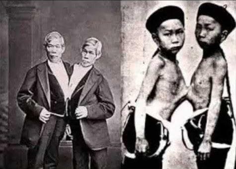 13 Super Weird And Disgusting Things On Display At The Mütter Museum