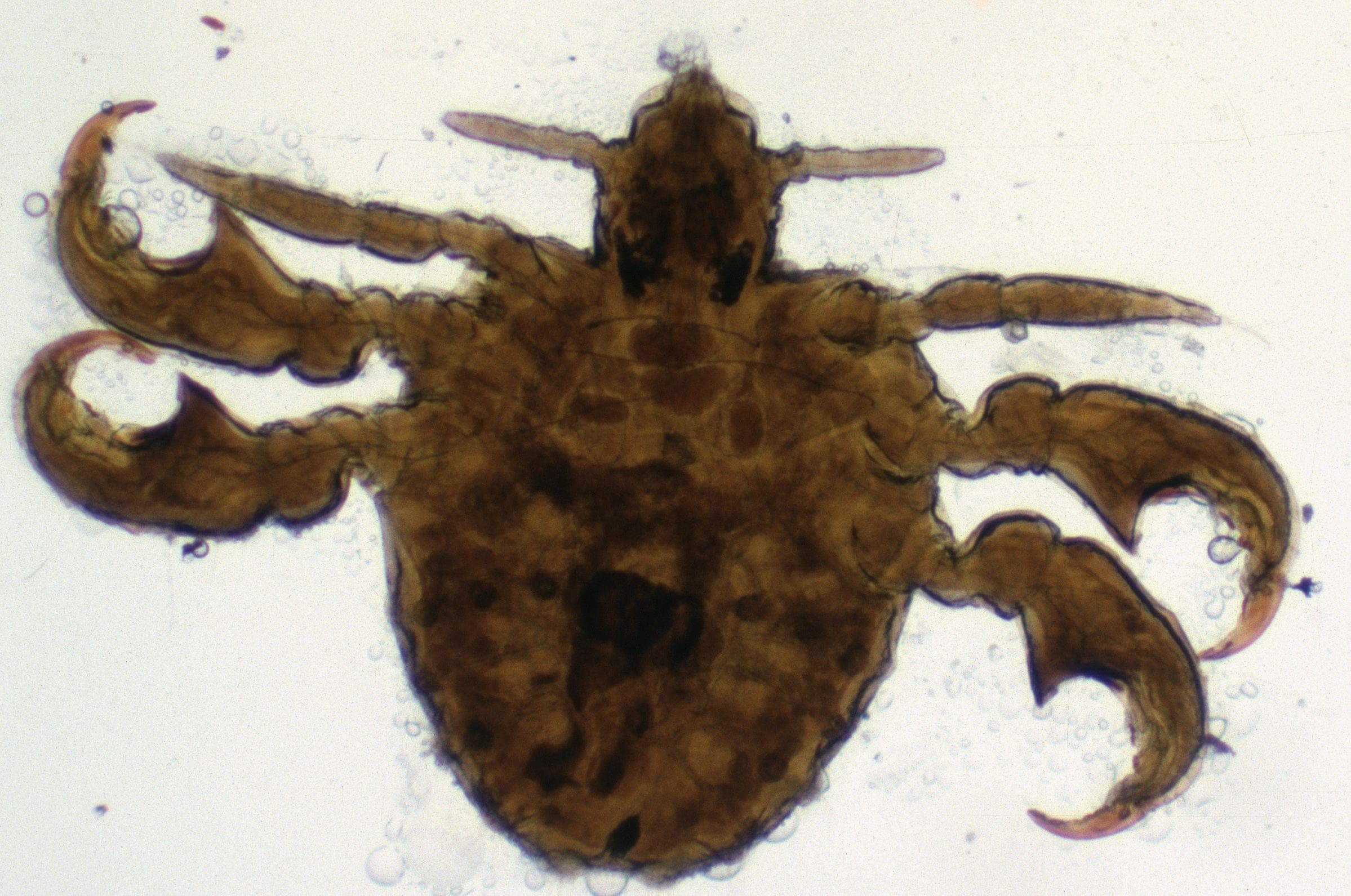 12 Disgusting Creatures That Live On Your Body