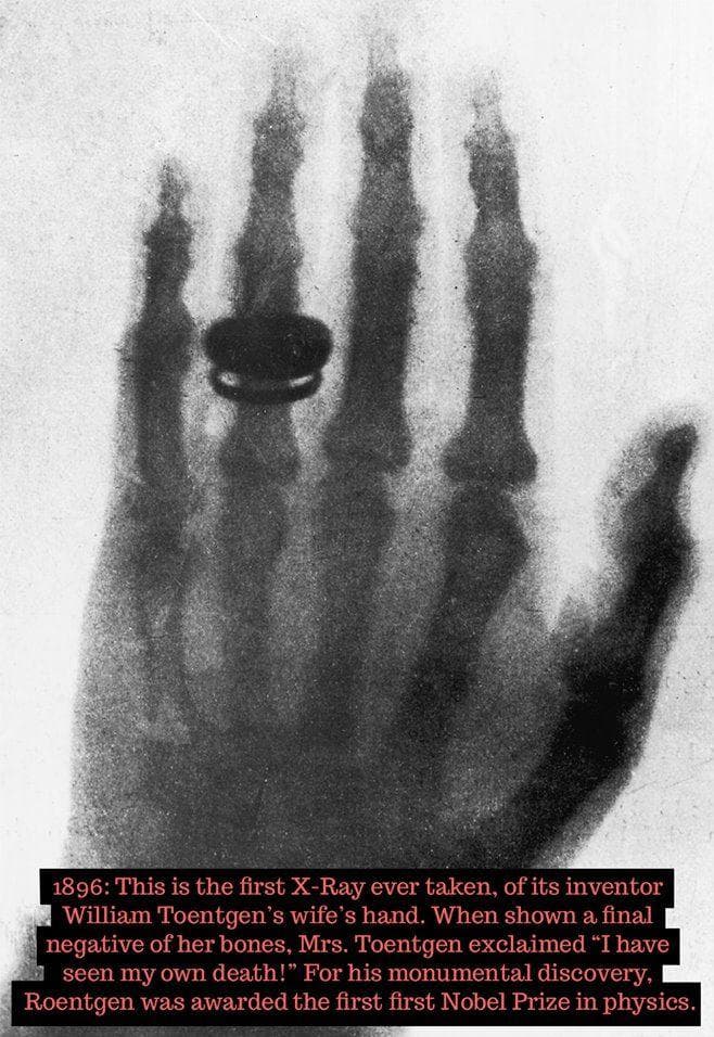 15 Medical Photos From History That Show How Hard We Had It