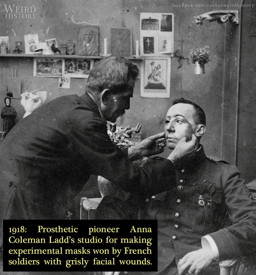 15 Medical Photos From History That Show How Hard We Had It