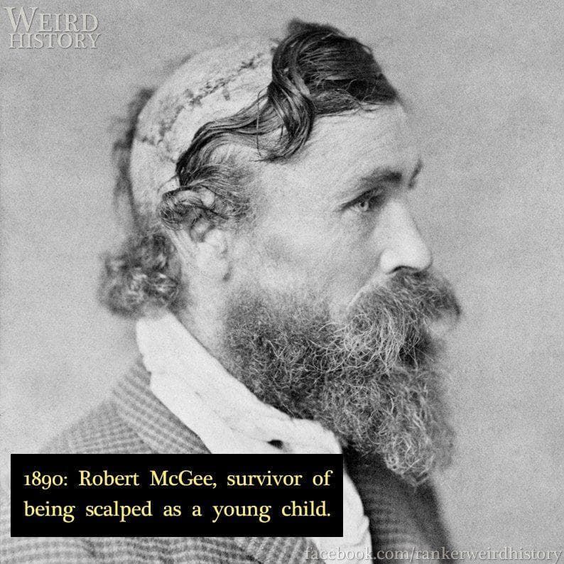 15 Medical Photos From History That Show How Hard We Had It