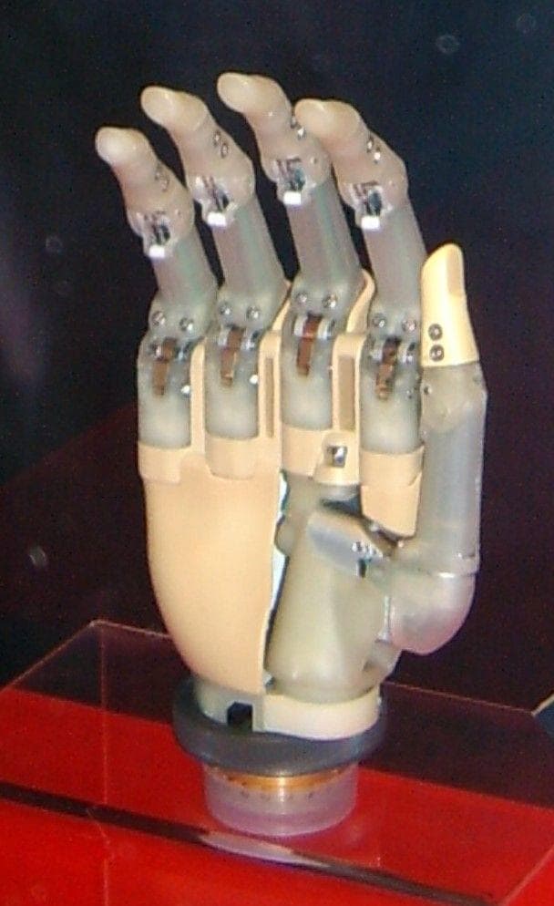 A Look Into How Bionic Prosthetics Work