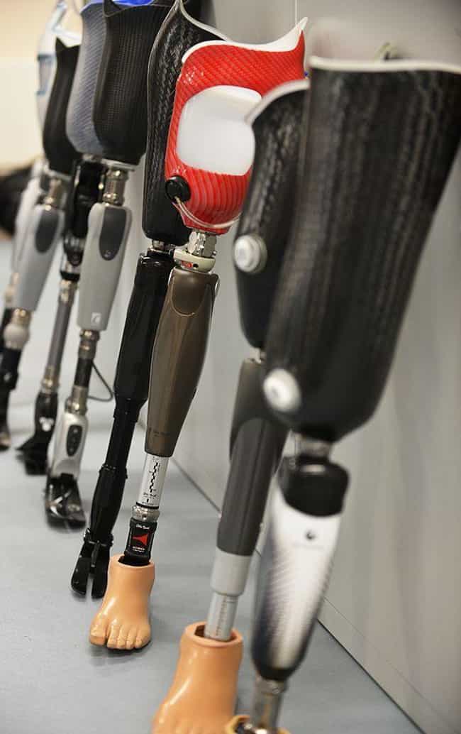 A Look Into How Bionic Prosthetics Work A Look Into How Bionic Prosthetics Work