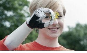 A Look Into How Bionic Prosthetics Work