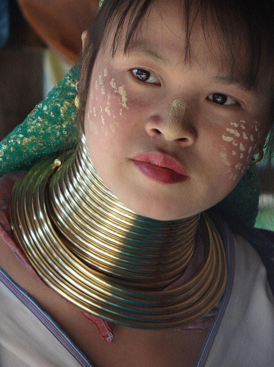 What Happens When Neck Rings Are Removed