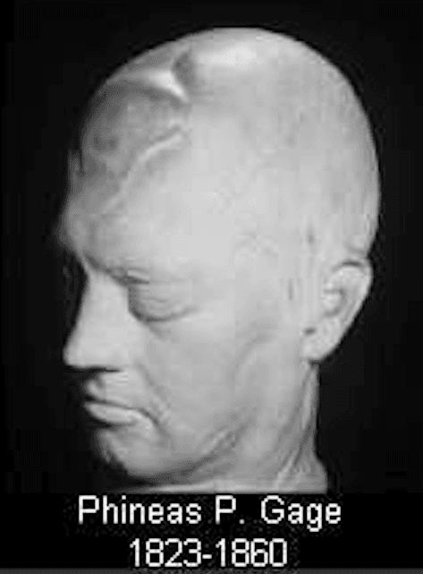 Horrifying Facts About Phineas Gage - The Man Who Impaled His Brain