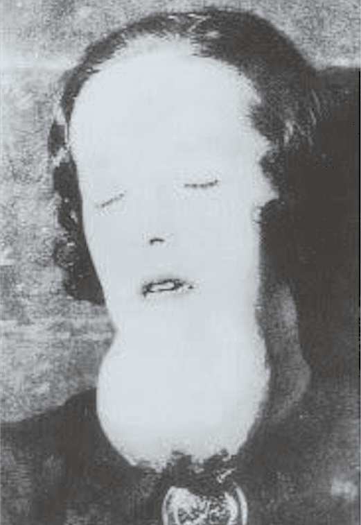 14 Horrifying Facts You Didn't Know About The Radium Girls