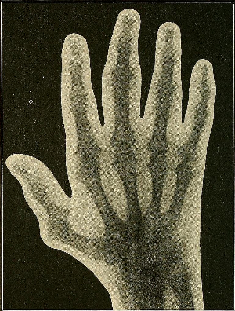 14 Horrifying Facts About The Radium Girls